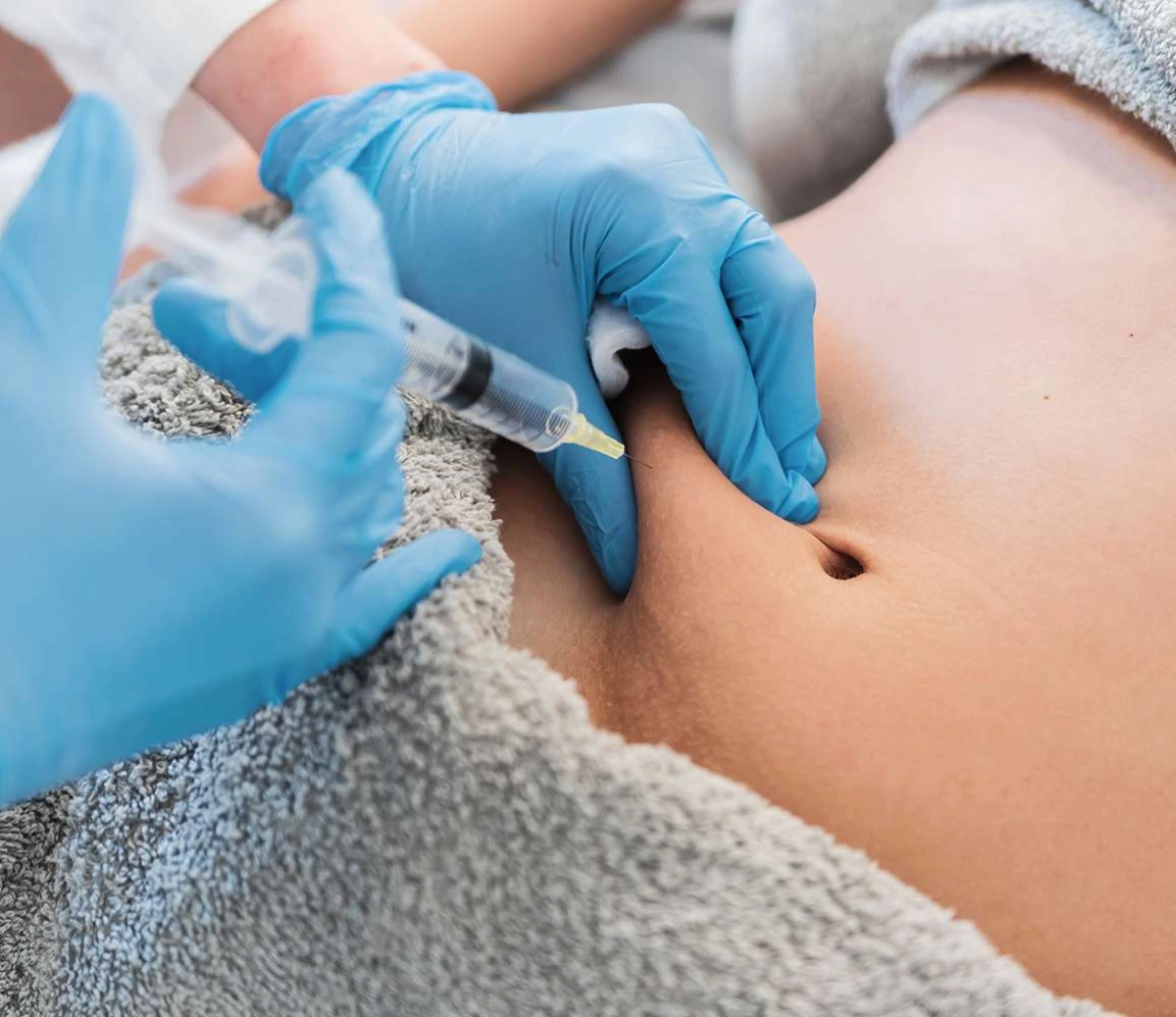 Permanent Fat Dissolving Injections | Toronto, Aurora & Vaughan