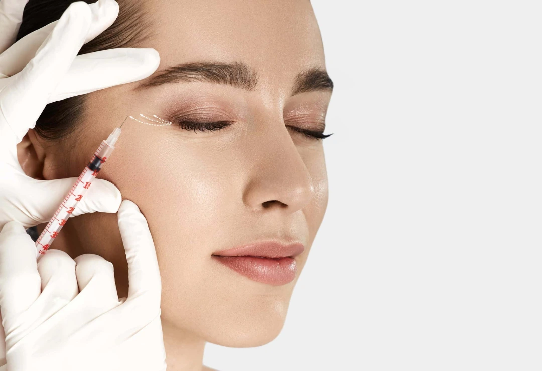 Crows Feet Treatment | Toronto, Aurora & Vaughan