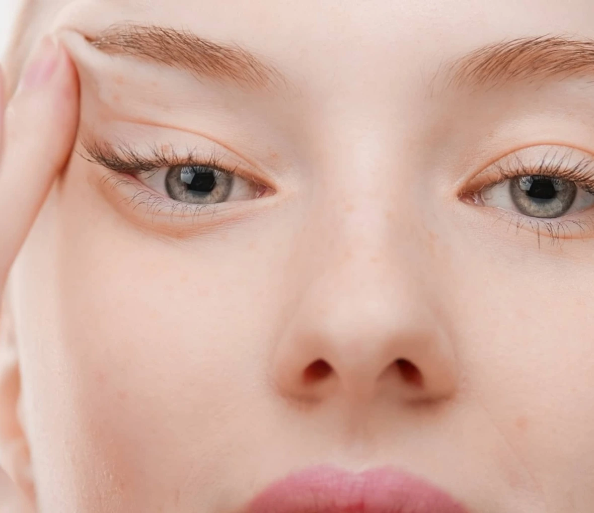 Eyebrow Lift | Toronto, Aurora & Vaughan